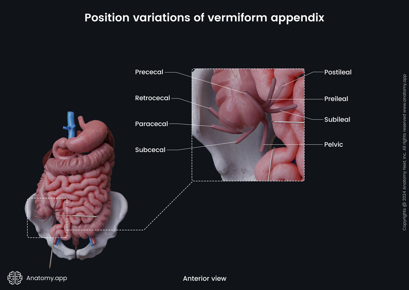 Cecum and vermiform appendix | Anatomy.app
