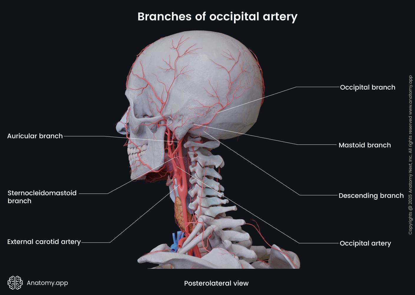 Internal Carotid Artery In Ear Aberrant Internal Carotid Artery In The