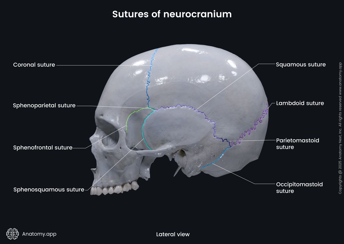 Sphenoparietal Suture