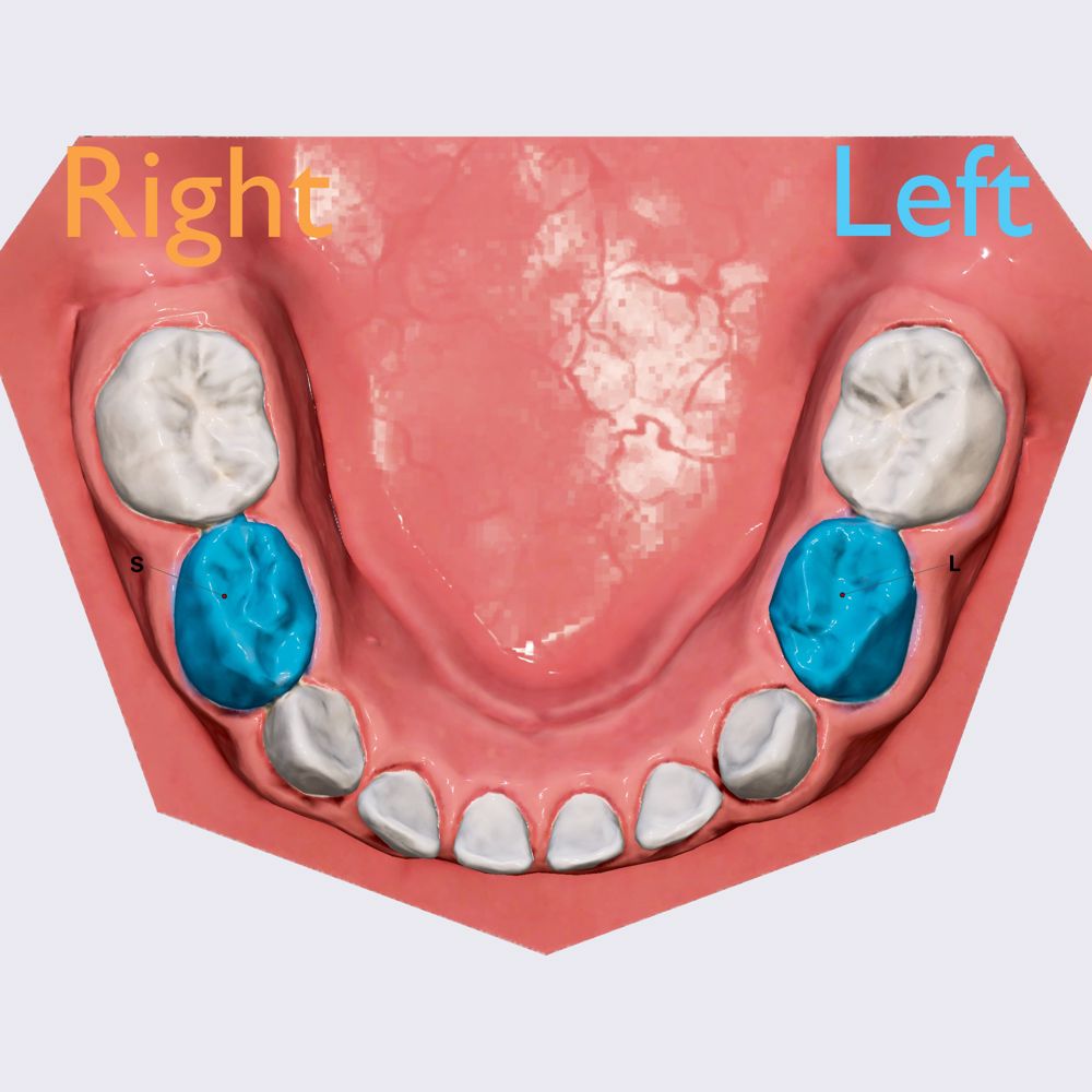 Primary Molars Anatomy