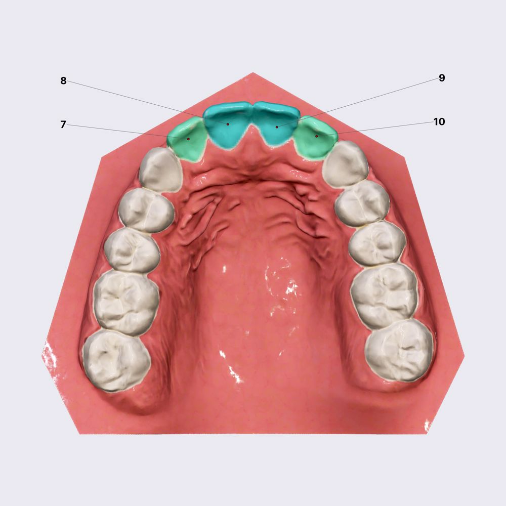 Dental Anatomy Of Maxillary Central Incisor Three Dimensional Finite