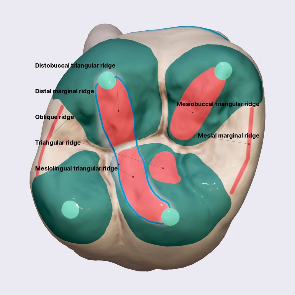 Upper First Molar Anatomy Molar Root Canal Anatomy | SpringerLink