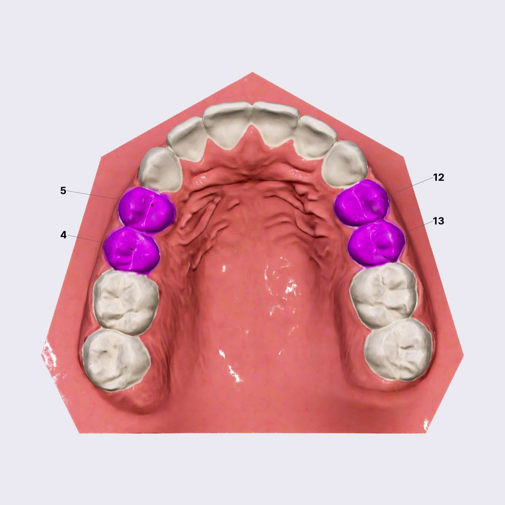 Maxillary Premolar Anatomy 9: The Permanent Maxillary Premolars