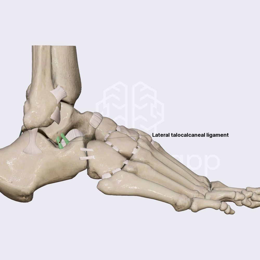 Lateral Talocalcaneal Ligament Arthritis And Other Abnormalities Of