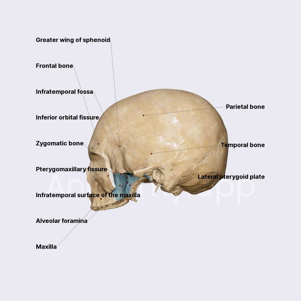 Infratemporal Fossa Venous Malformation In The Infratemporal Fossa