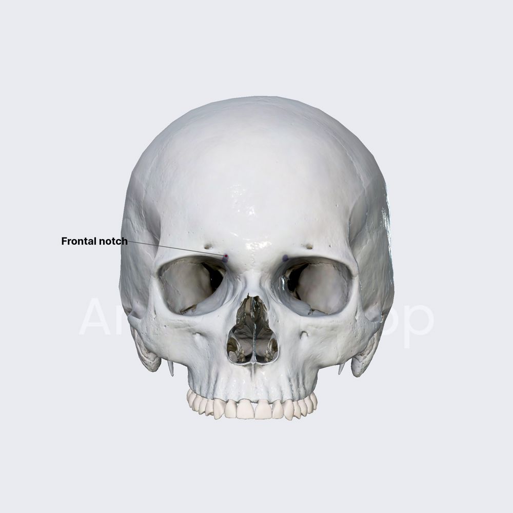 Frontal Notch Frontal Bone Nasal Bone Glabella Lacrimal Bone