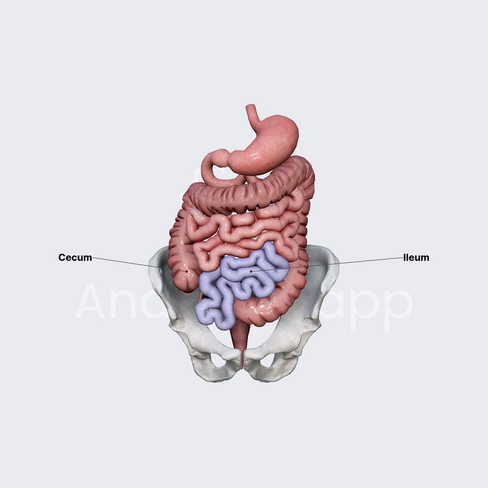 Ileum A Case Of Pedunculated Grade 2 Neuroendocrine Tumor In The Ileum
