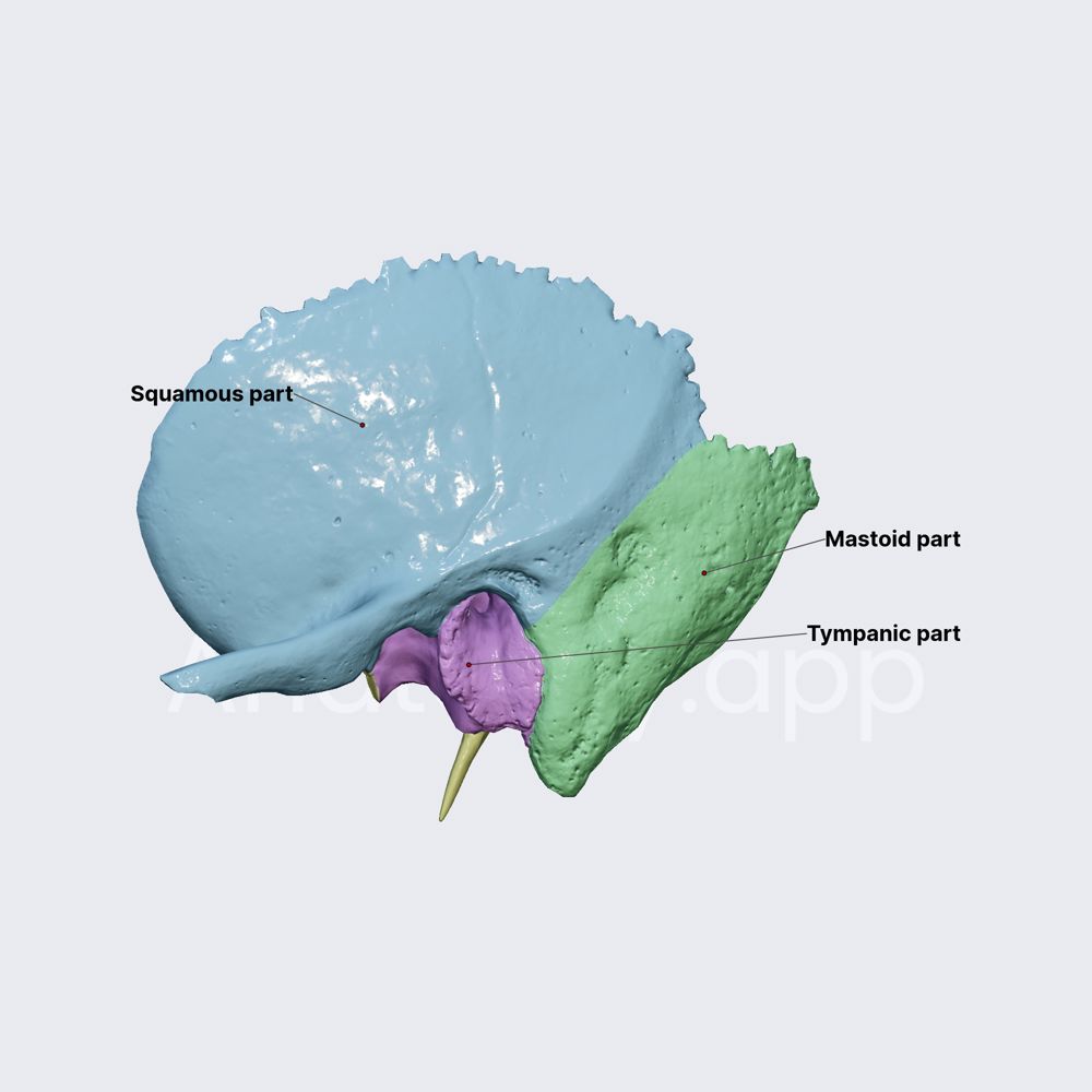 Temporal Bone A New 3D Printed Temporal Bone: 'the SAPIENS'—specific