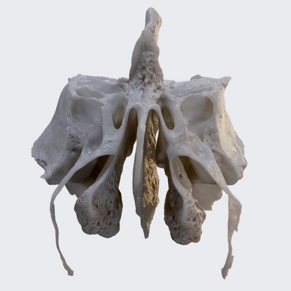 Ethmoid Bone Anatomy